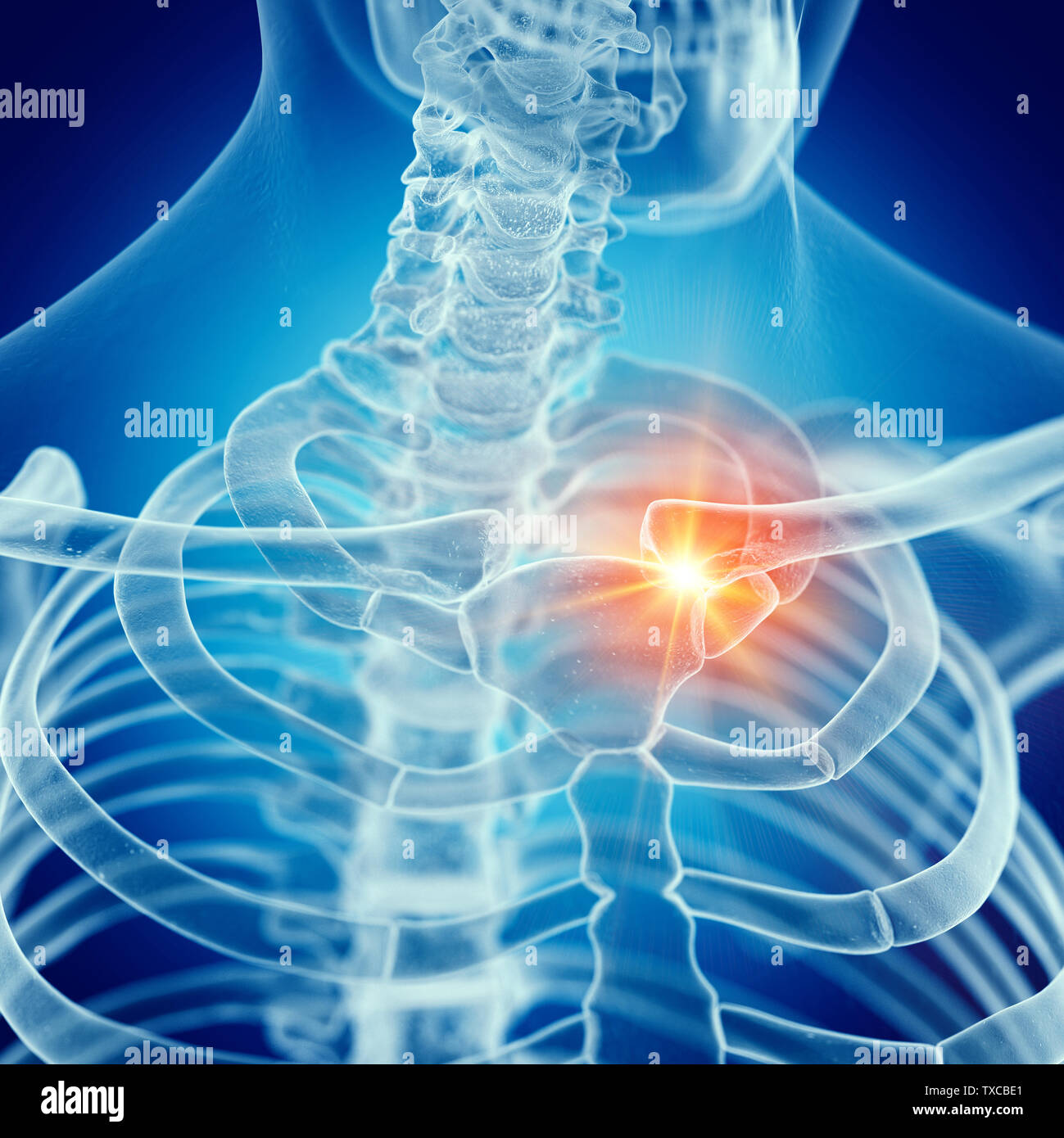3d rendered medically accurate illustration of a painful clavicle Stock ...