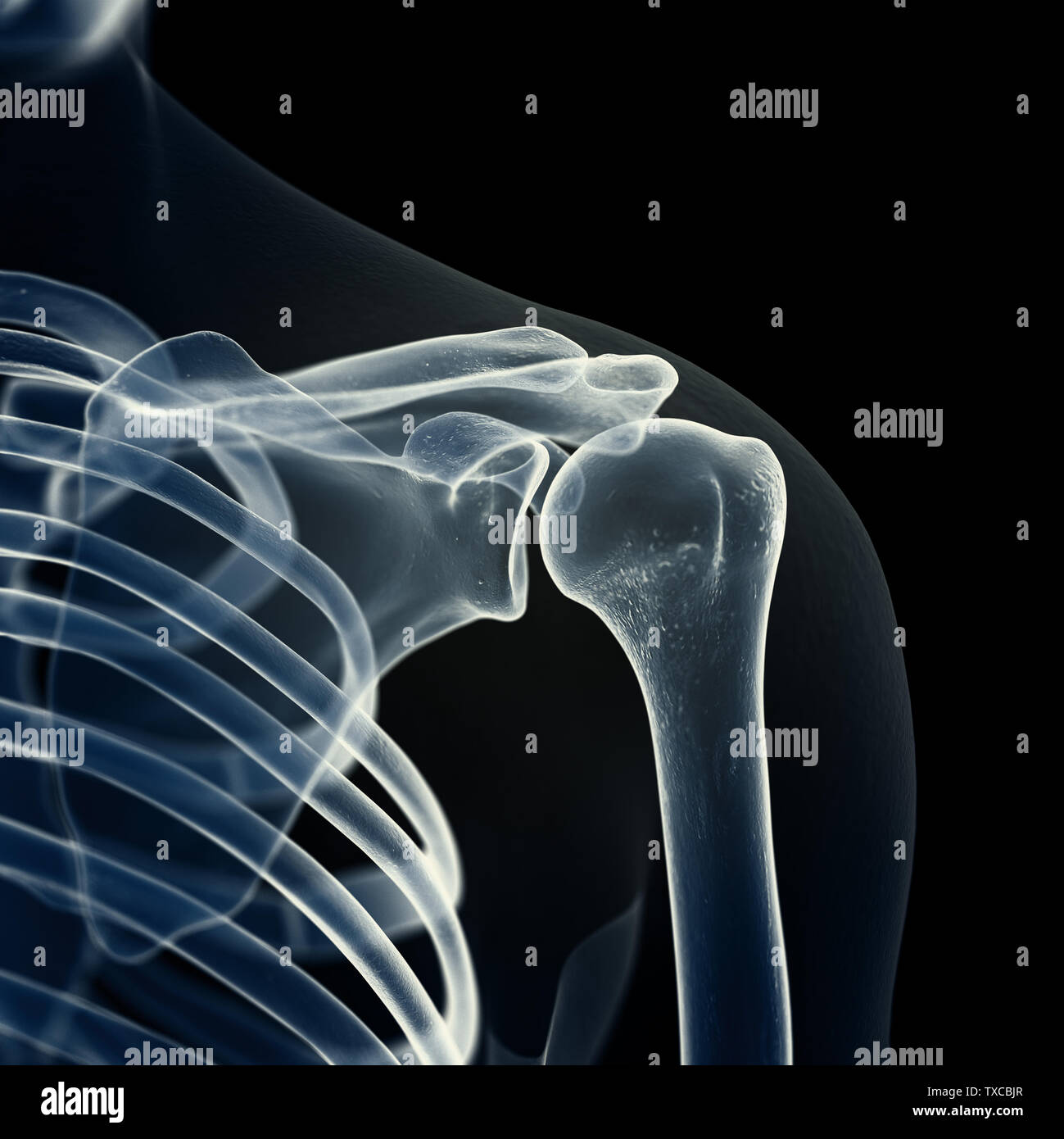 Shoulder xray hi-res stock photography and images - Alamy