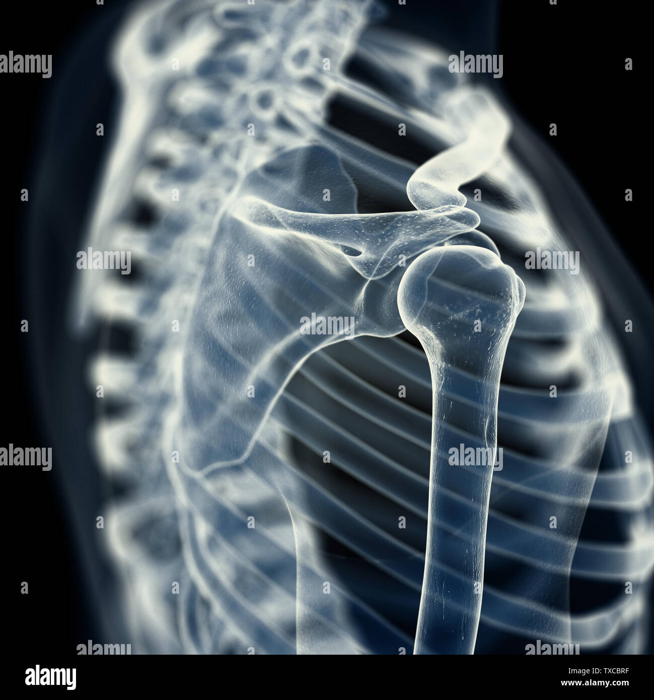 Shoulder xray hi-res stock photography and images - Alamy