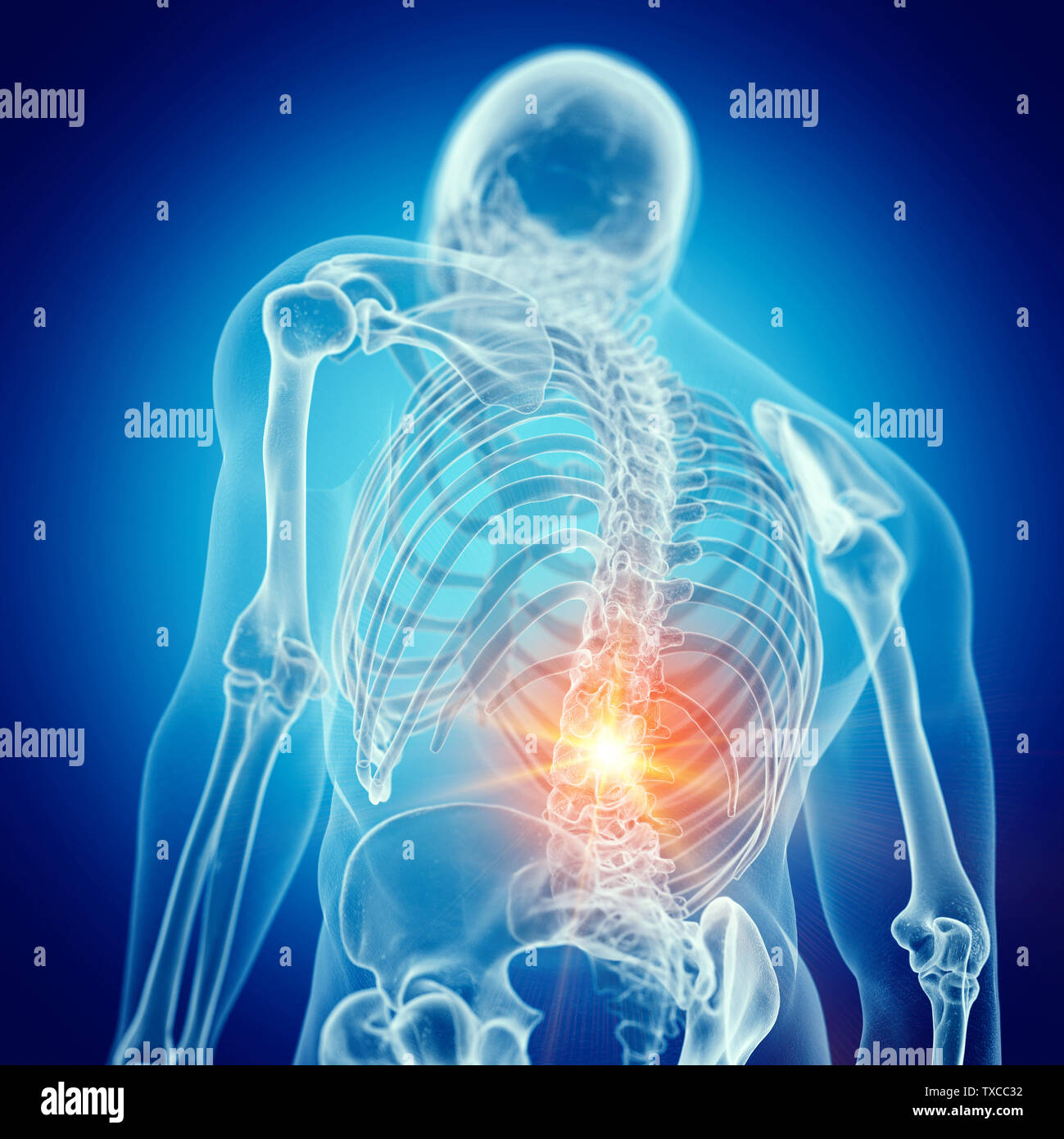 Lower back pain illustration hi-res stock photography and images - Alamy