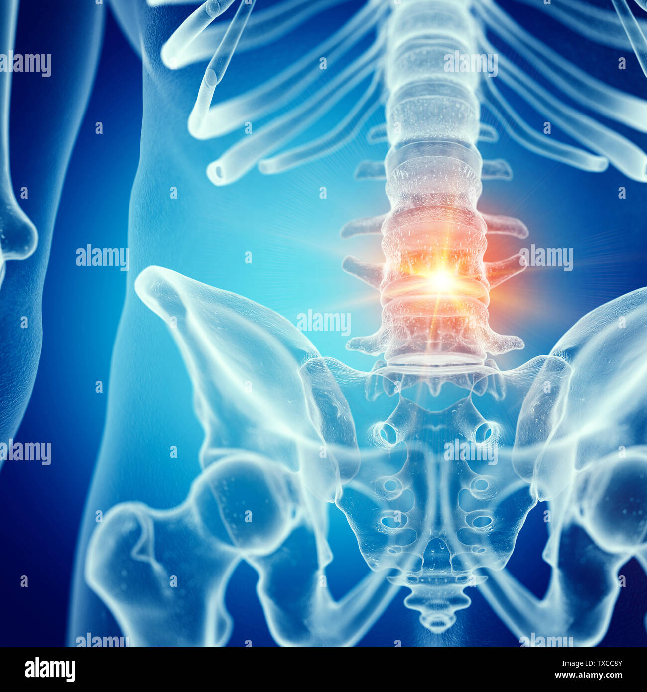 3d rendered medically accurate illustration of lower back pain Stock ...