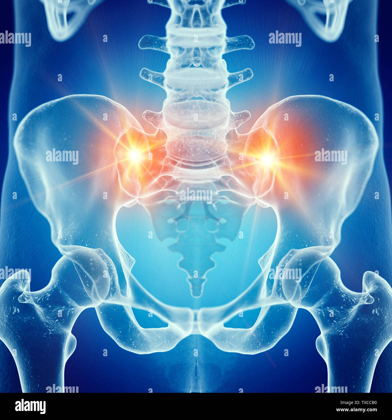 3d rendered medically accurate illustration of a painful sacrum joint ...