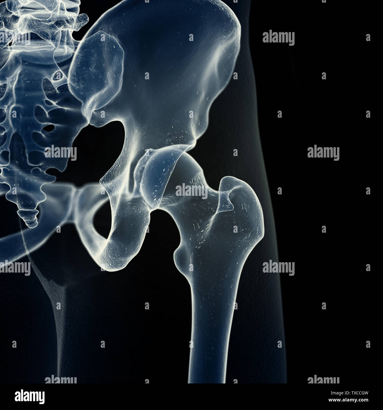 Hip scan hi-res stock photography and images - Alamy