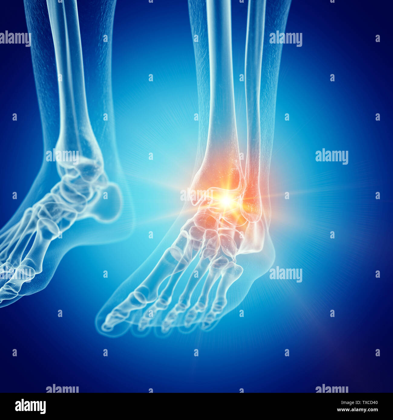 3d rendered medically accurate illustration of a painful ankle Stock ...