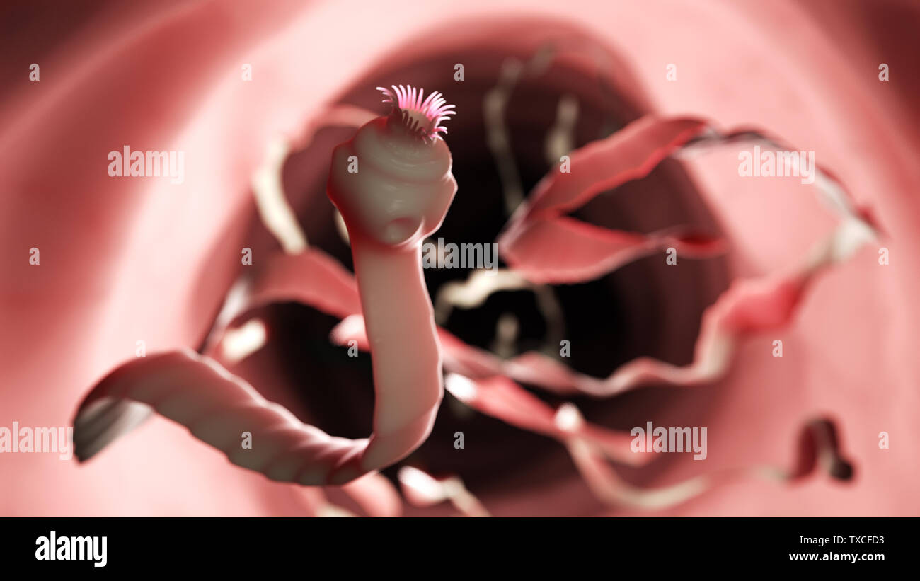3d rendered medically accurate illustration of a tape worm Stock Photo ...