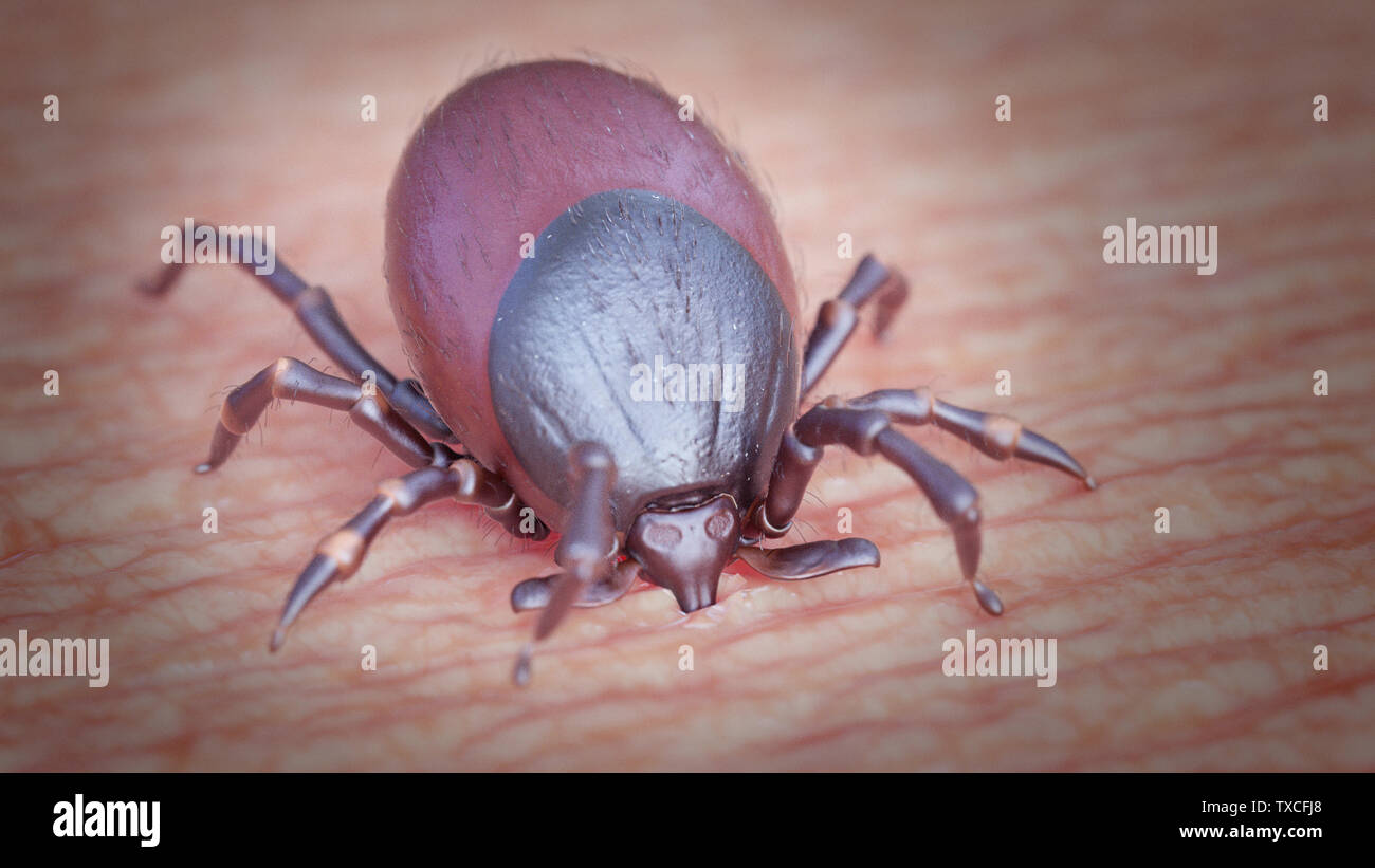 3d rendered illustration of a tick biting a human Stock Photo - Alamy