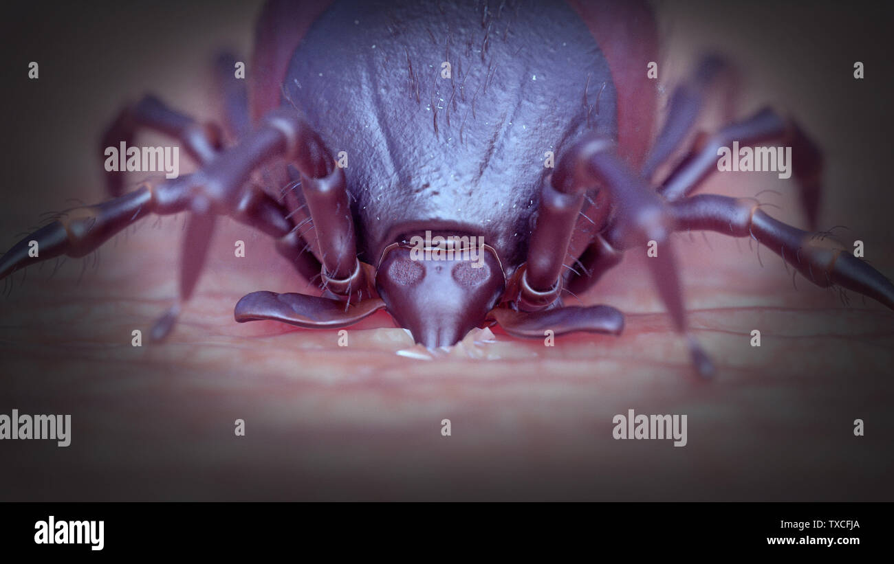 3d rendered illustration of a tick biting a human Stock Photo - Alamy