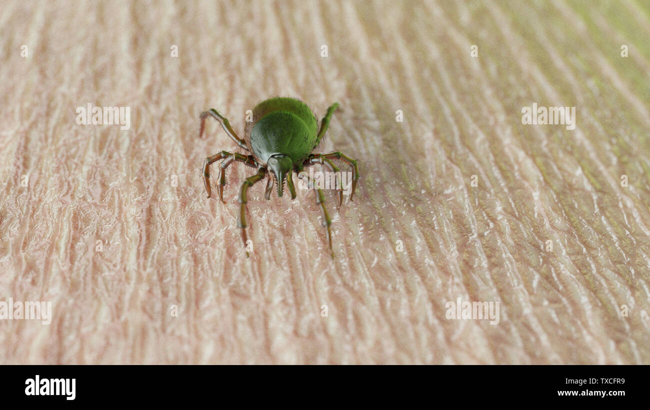 3d rendered illustration of a tick on skin Stock Photo - Alamy