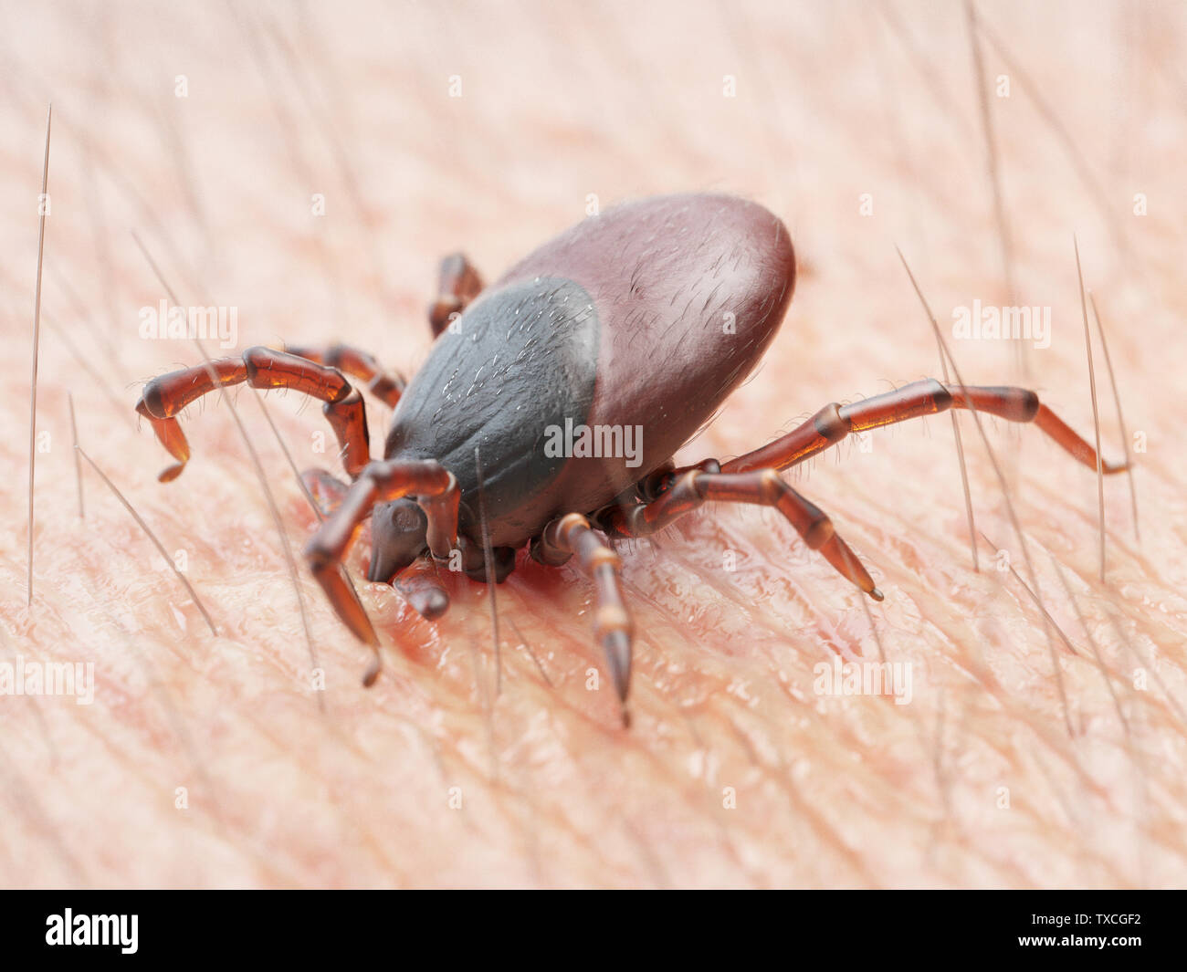 3d rendered illustration of a tick biting in human skin Stock Photo - Alamy