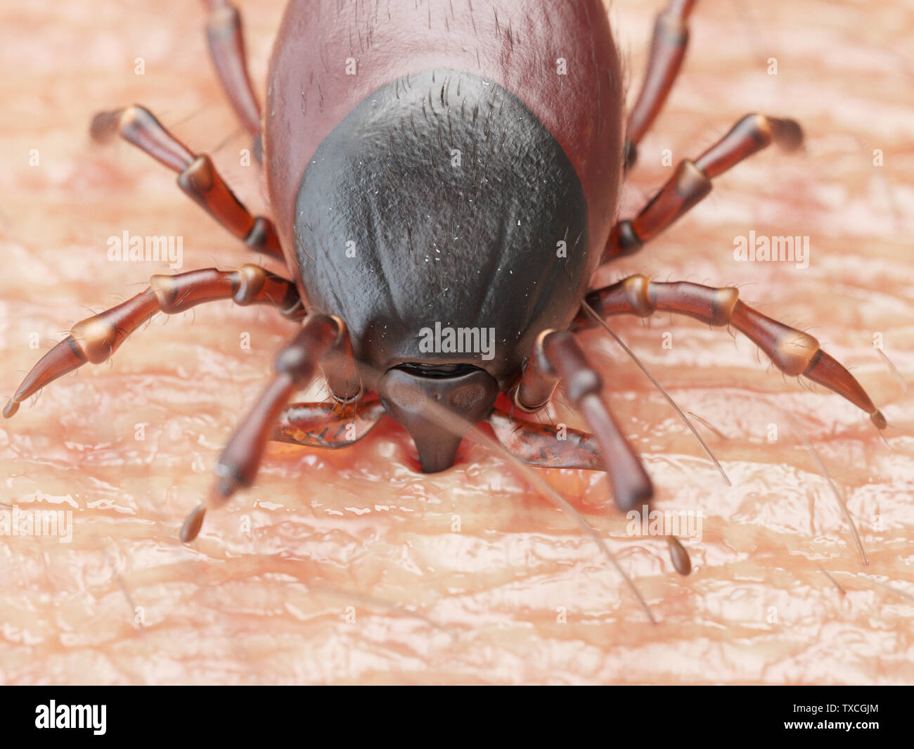 3d rendered medically accurate illustration of a tick bite Stock Photo ...