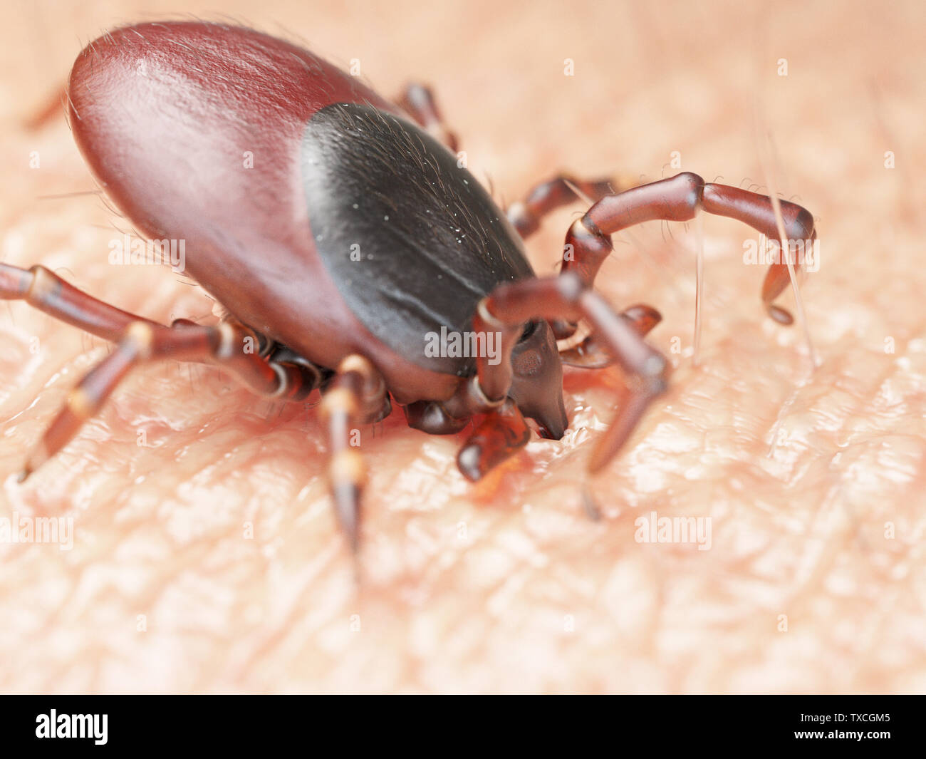 3d rendered medically accurate illustration of a tick bite Stock Photo ...