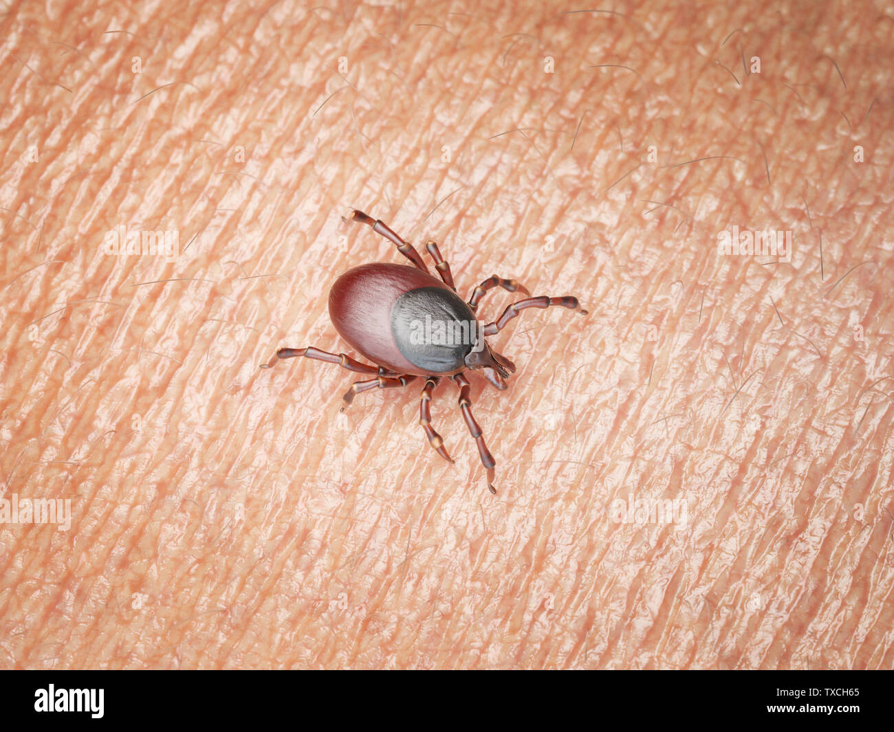 3d rendered illustration of a tick crawling on human skin Stock Photo ...