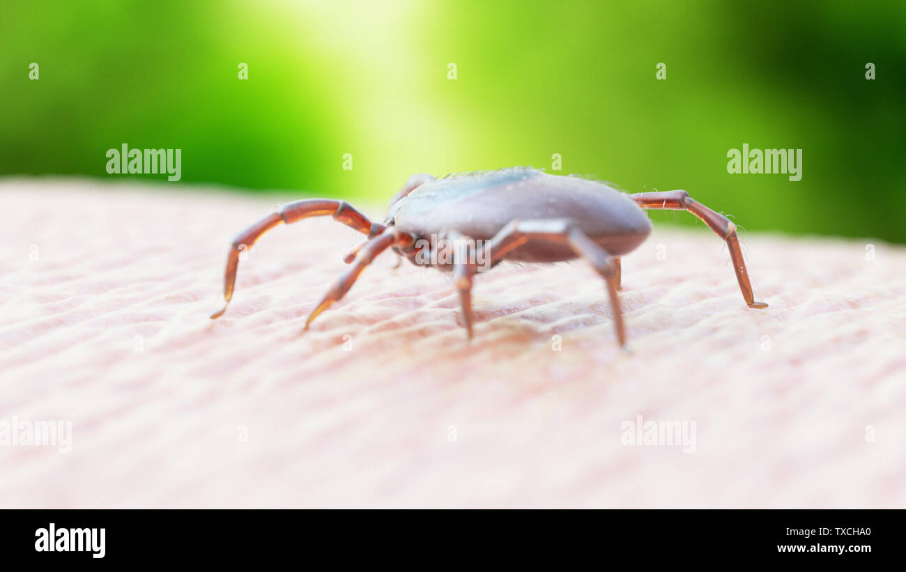 3d rendered illustration of a tick crawling on human skin Stock Photo ...