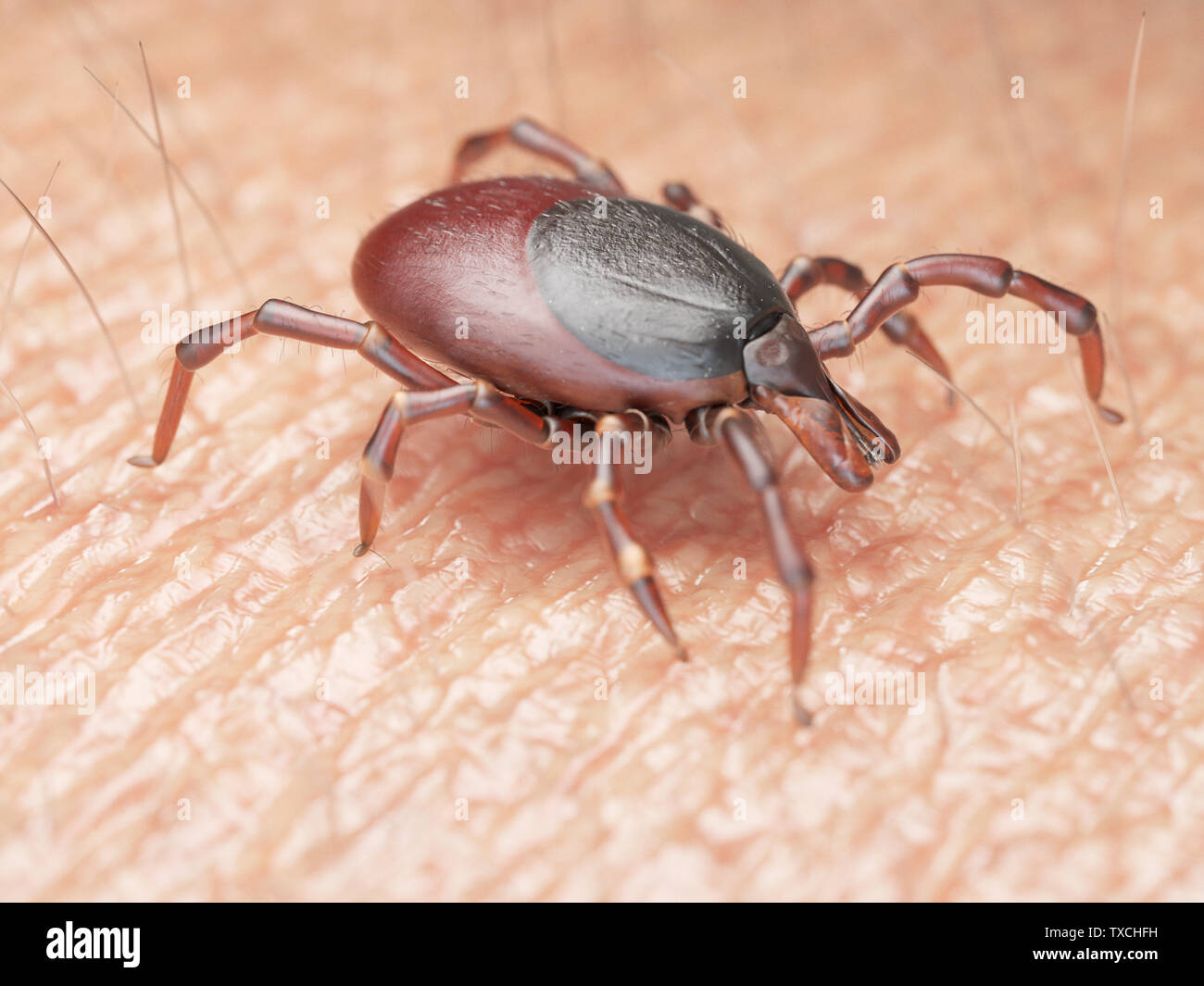 3d rendered illustration of a tick crawling on human skin Stock Photo ...