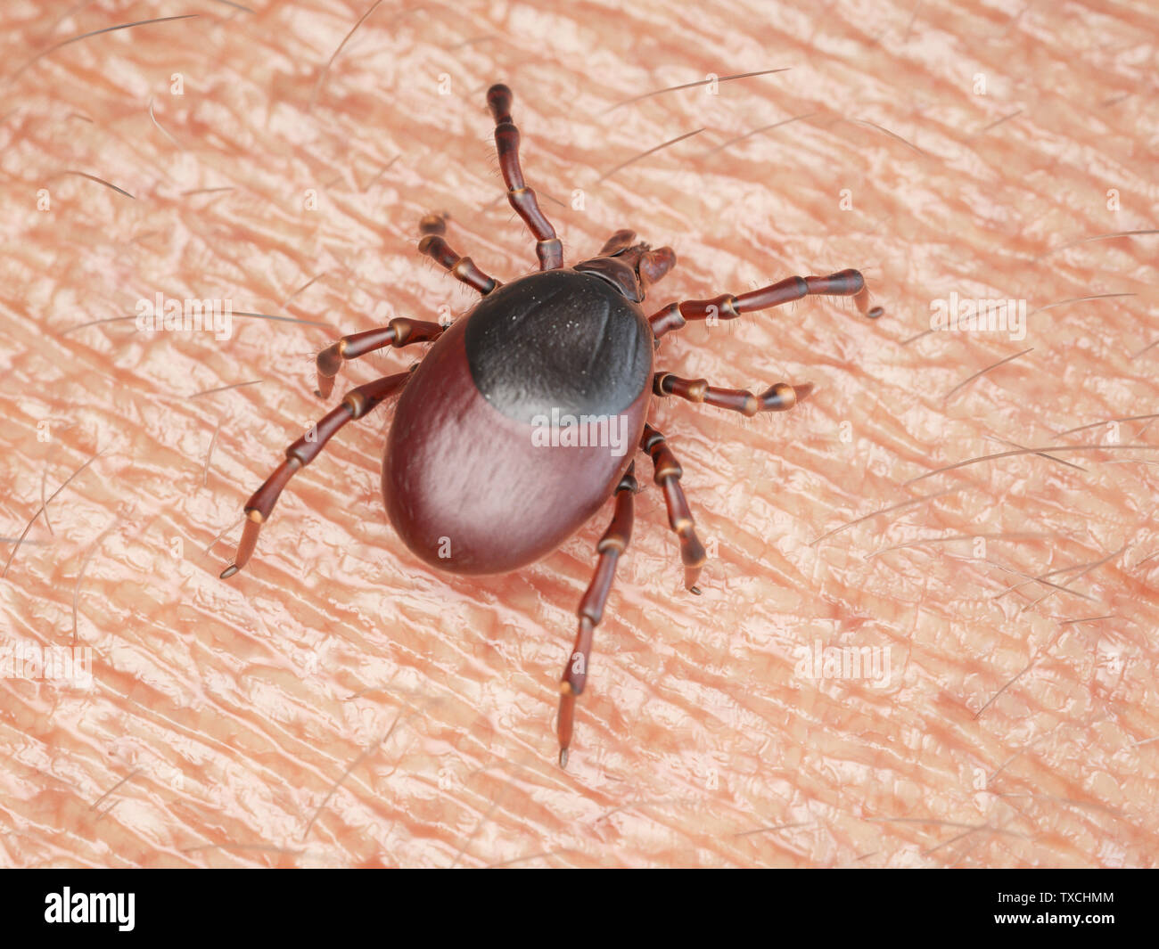 3d rendered illustration of a tick crawling on human skin Stock Photo ...