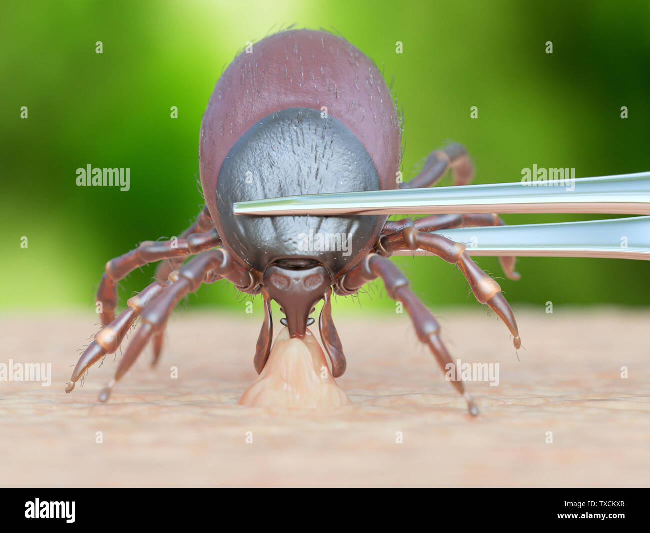 3d rendered illustration of a tick being removed Stock Photo - Alamy