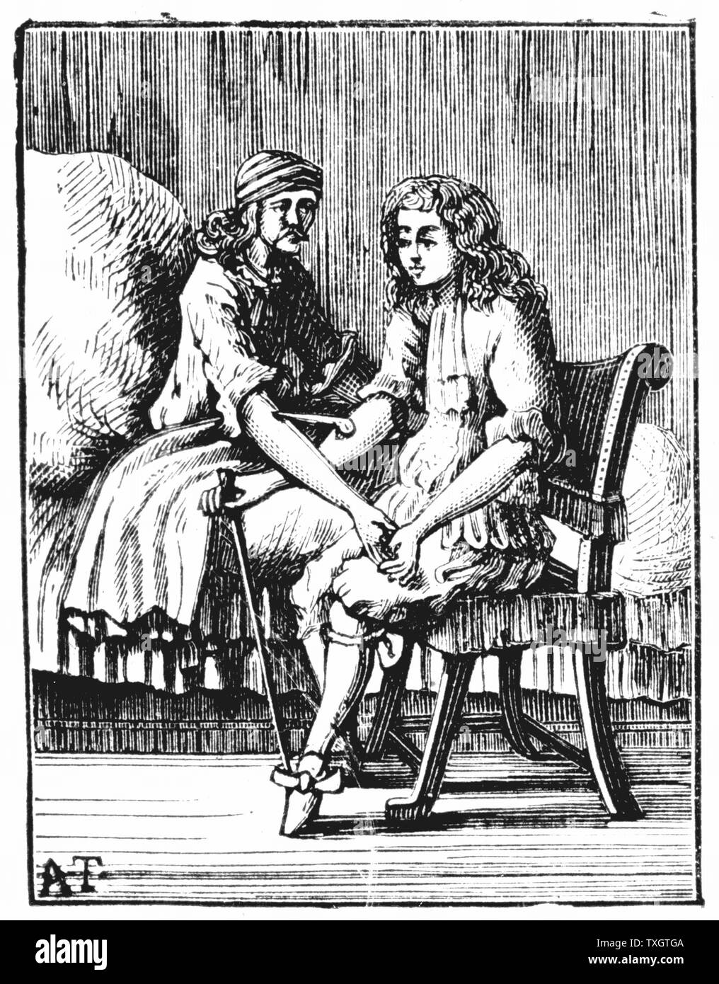 Direct person-to-person blood transfusion 1679 After engraving from ...