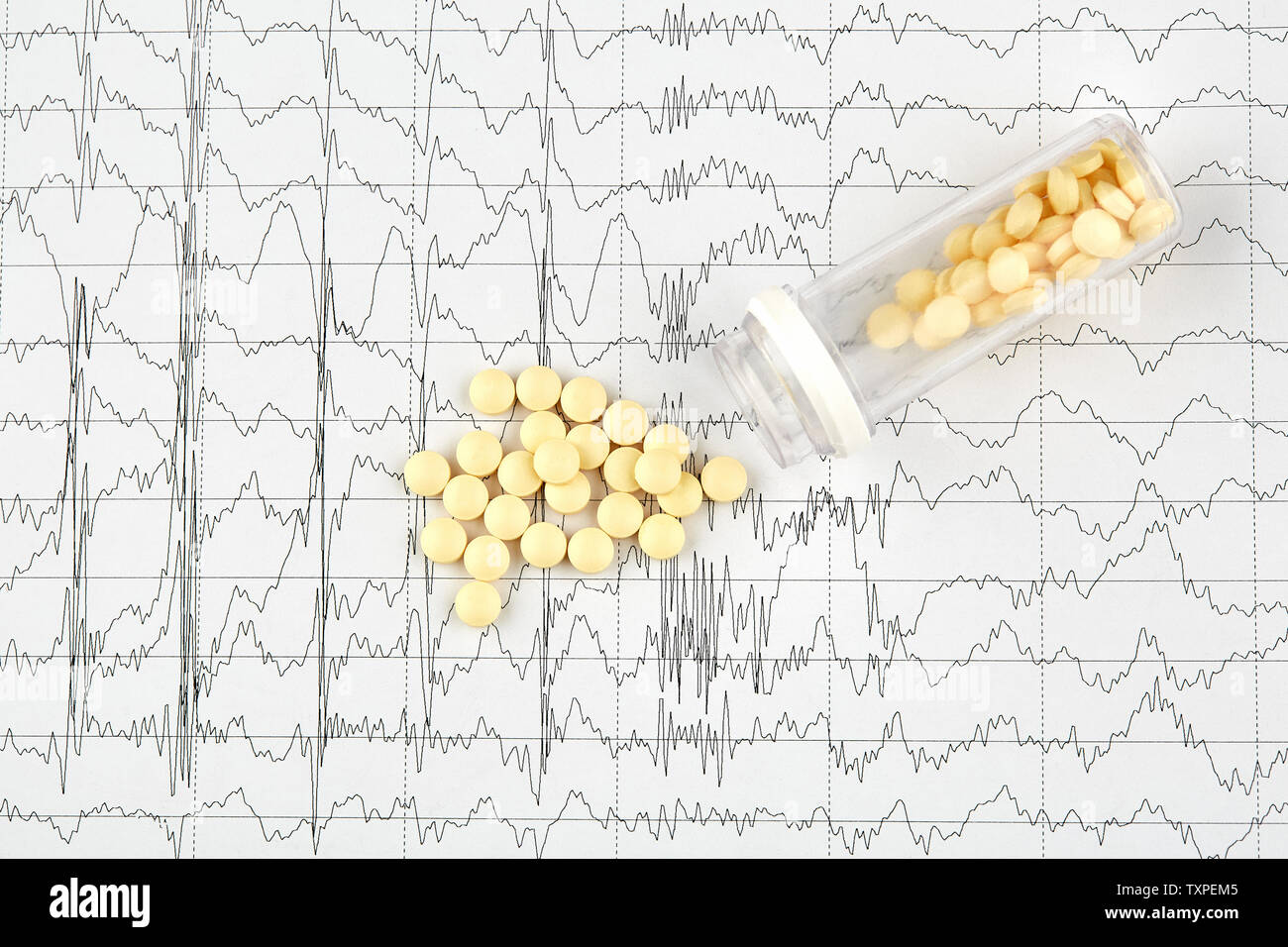 Close-up photo of yellow pills and vial on EKG graph Stock Photo - Alamy