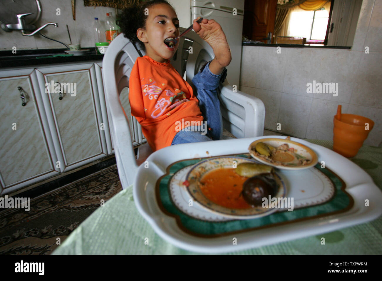 A Palestinian girl, nine-year-old Aya Wael Masoud, who was born without ...