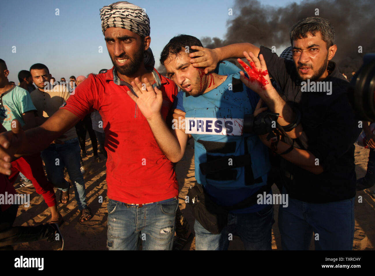 Palestinian protestors evacuate injured journalist Mahmoud Bassam ...