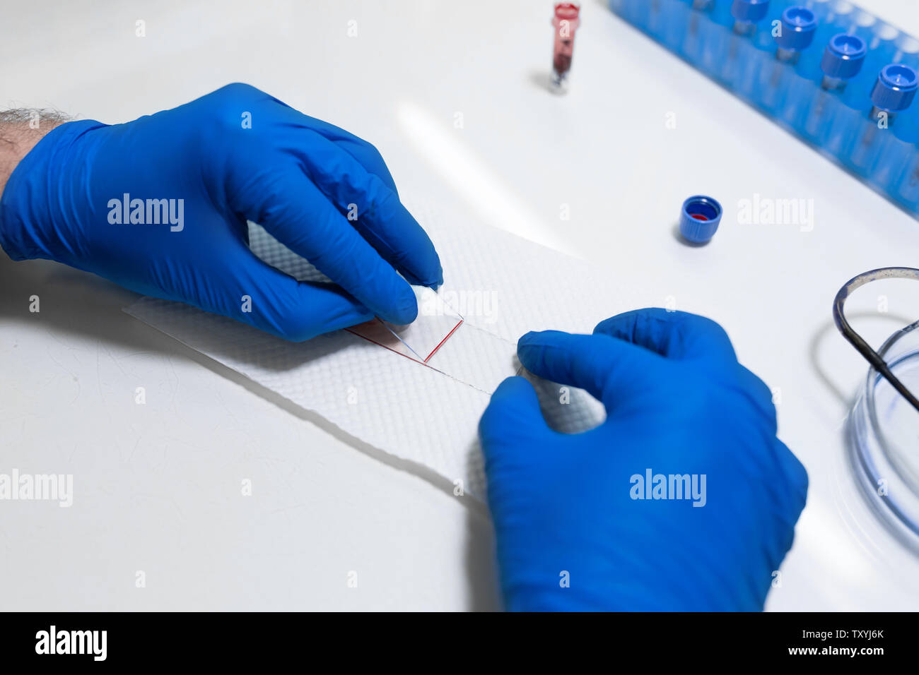 scientist prepare blood sample for research on microscope. Placing ...