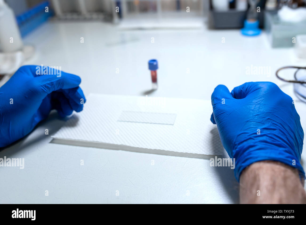 scientist prepare blood sample for research on microscope. Placing ...