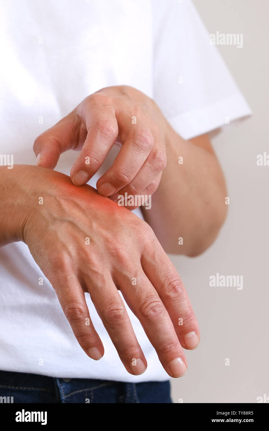 Woman Scratching an itch . Sensitive Skin, Food allergy symptoms ...