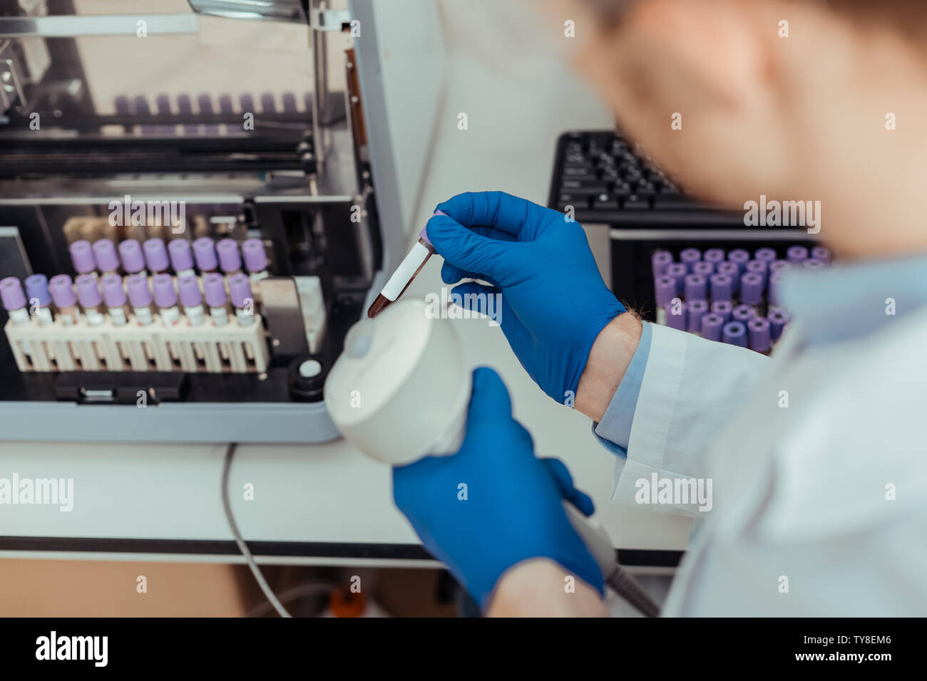 Blood analysis in hands hi-res stock photography and images - Alamy