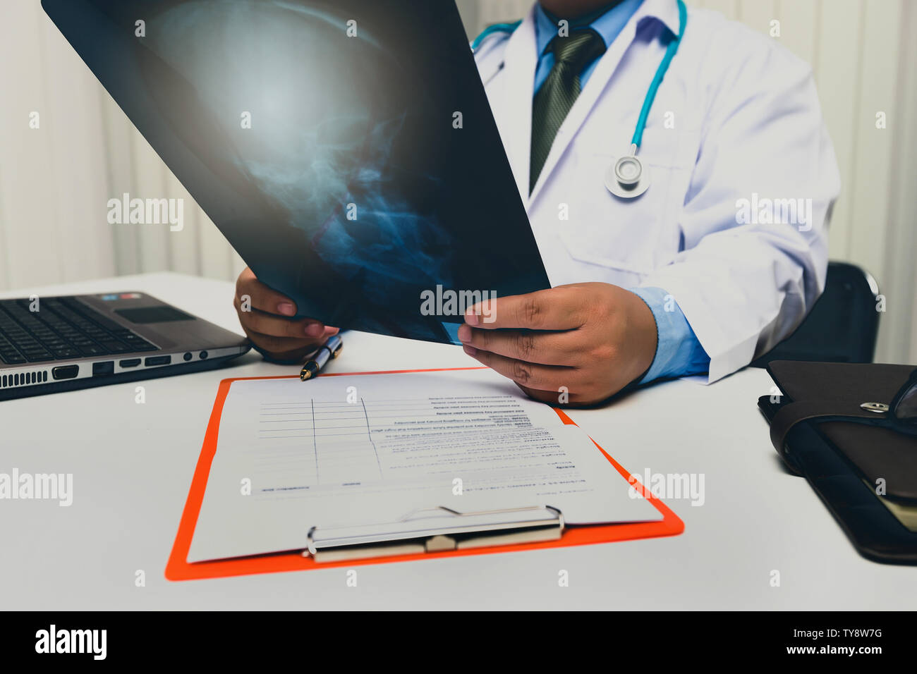 Doctor diagnose and analyze on x-ray film of patient Stock Photo - Alamy