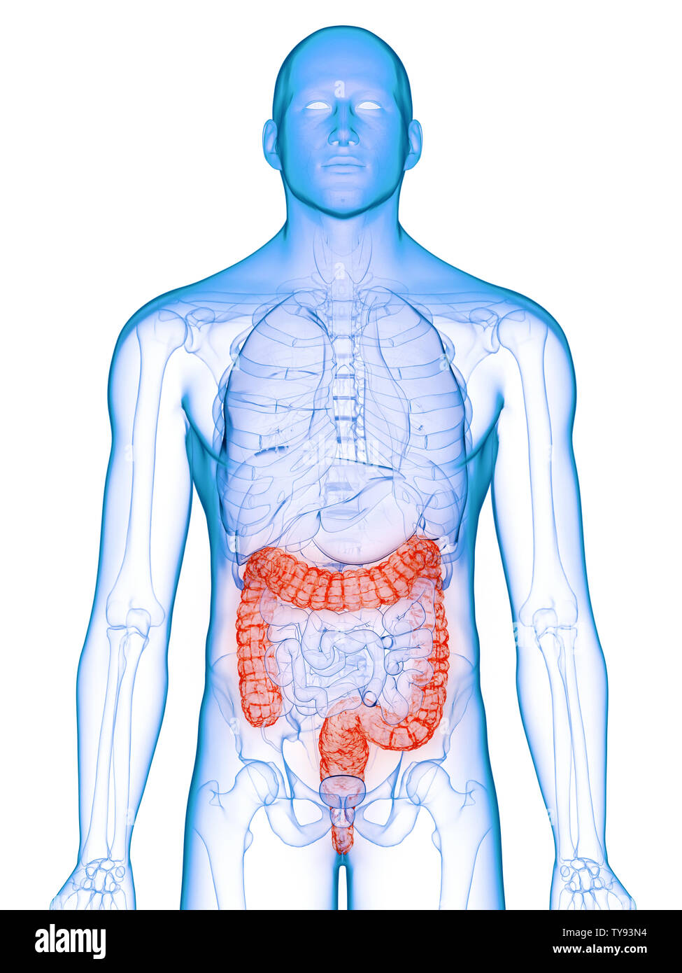 3d rendered medically accurate illustration of a diseased colon Stock ...