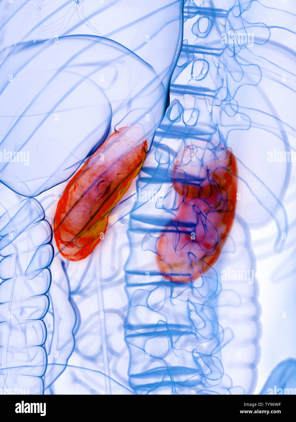 3d rendered medically accurate illustration of a diseased kidney Stock ...