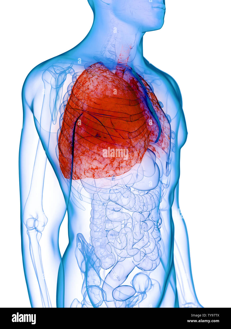 3d rendered medically accurate illustration of a diseased lung Stock ...