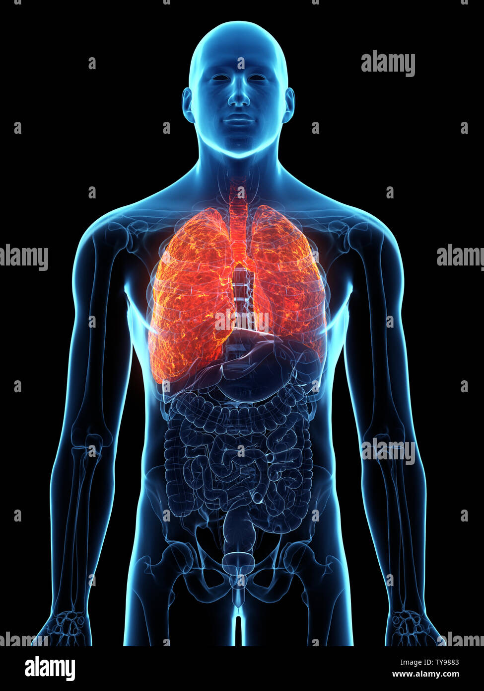 3d rendered medically accurate illustration of a diseased lung Stock ...