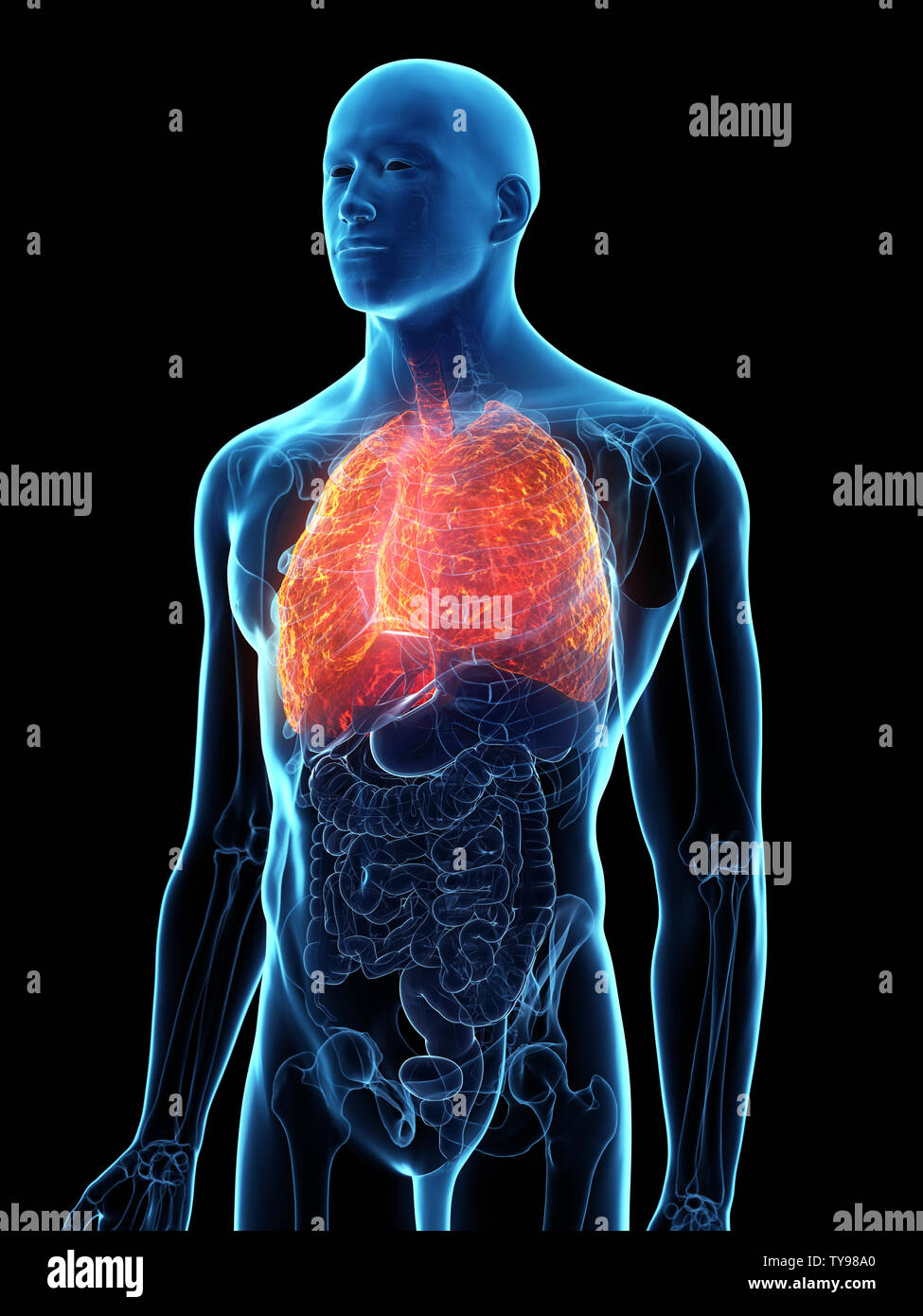 3d rendered medically accurate illustration of a diseased lung Stock ...