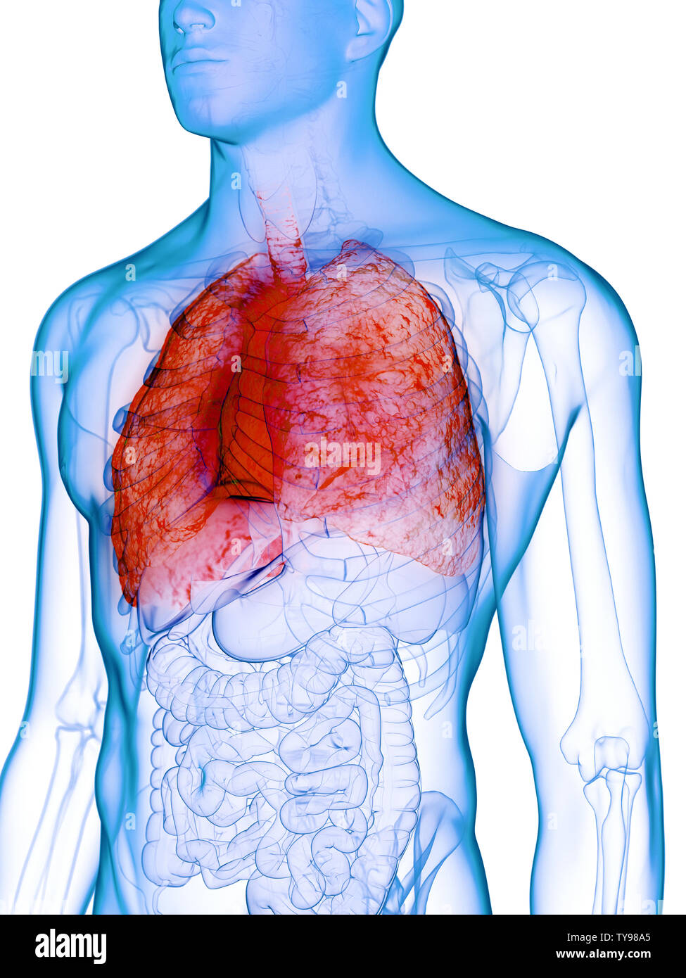 3d rendered medically accurate illustration of a diseased lung Stock ...
