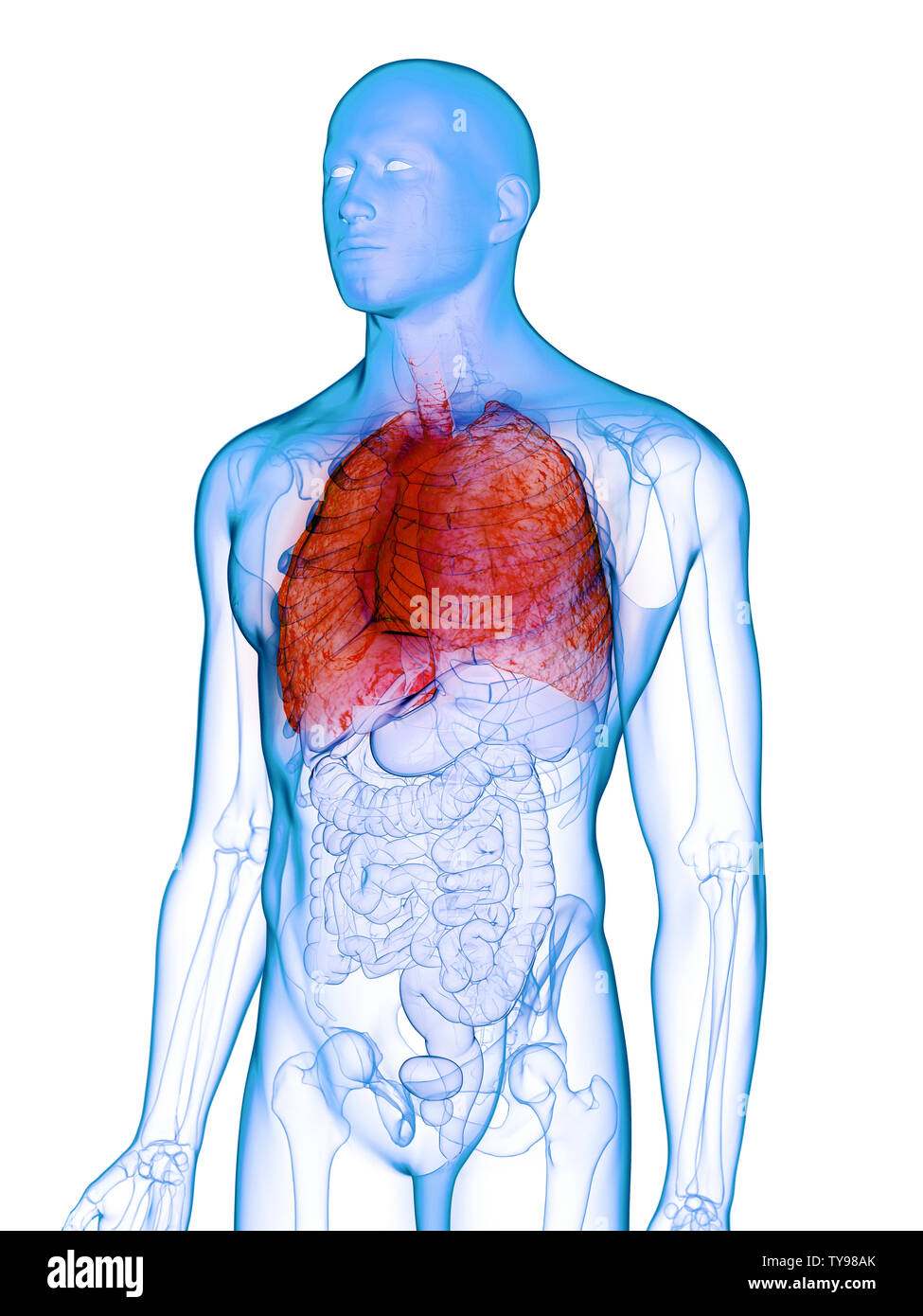 3d rendered medically accurate illustration of a diseased lung Stock ...