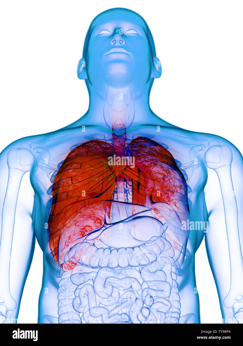 3d rendered medically accurate illustration of a diseased lung Stock ...