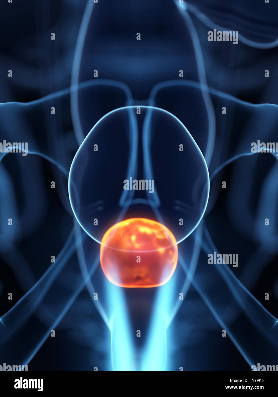 Inflammation of the prostate hi-res stock photography and images - Alamy