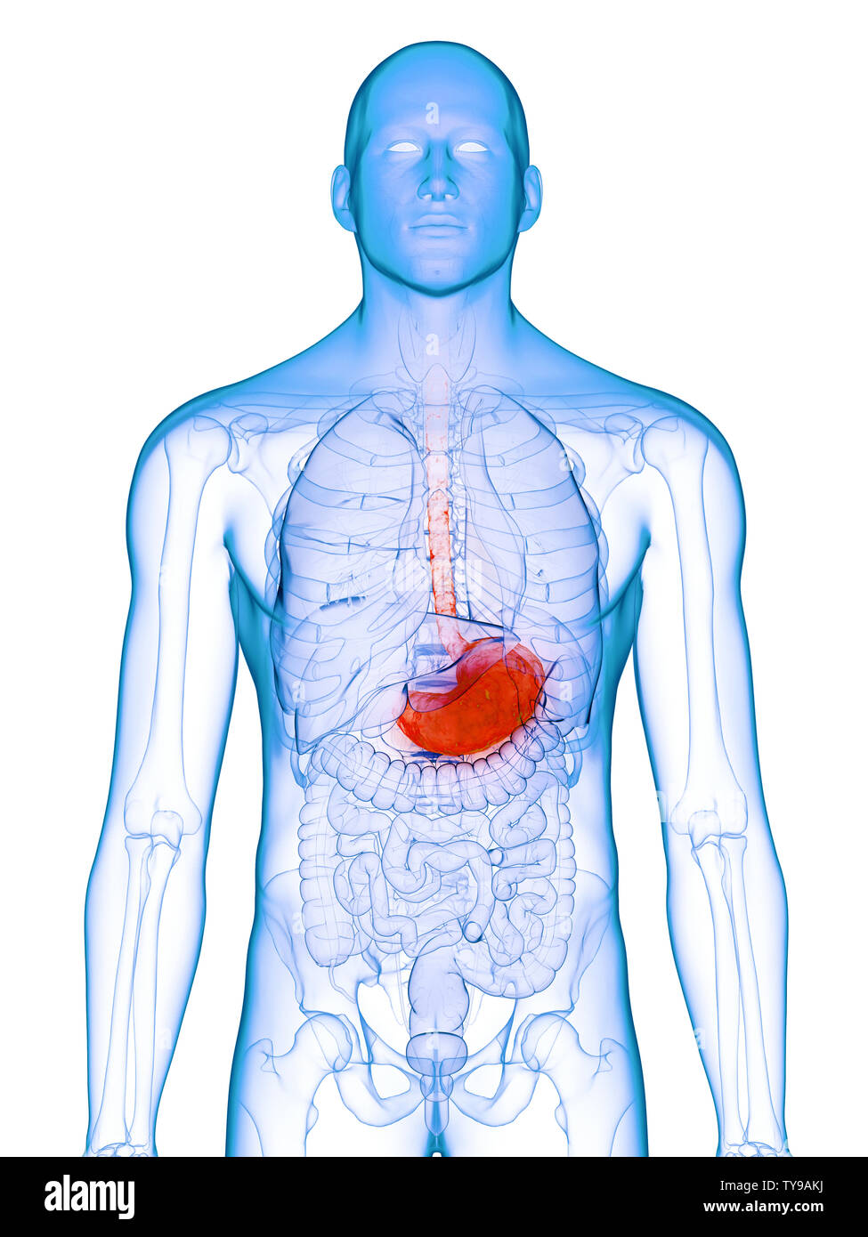 3d rendered medically accurate illustration of a diseased stomach Stock ...