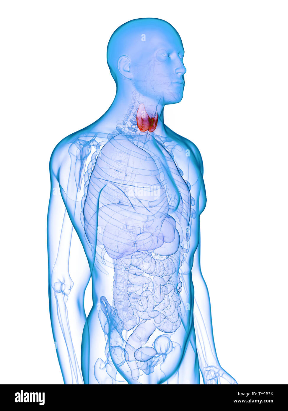 3d rendered medically accurate illustration of a diseased thyroid gland ...
