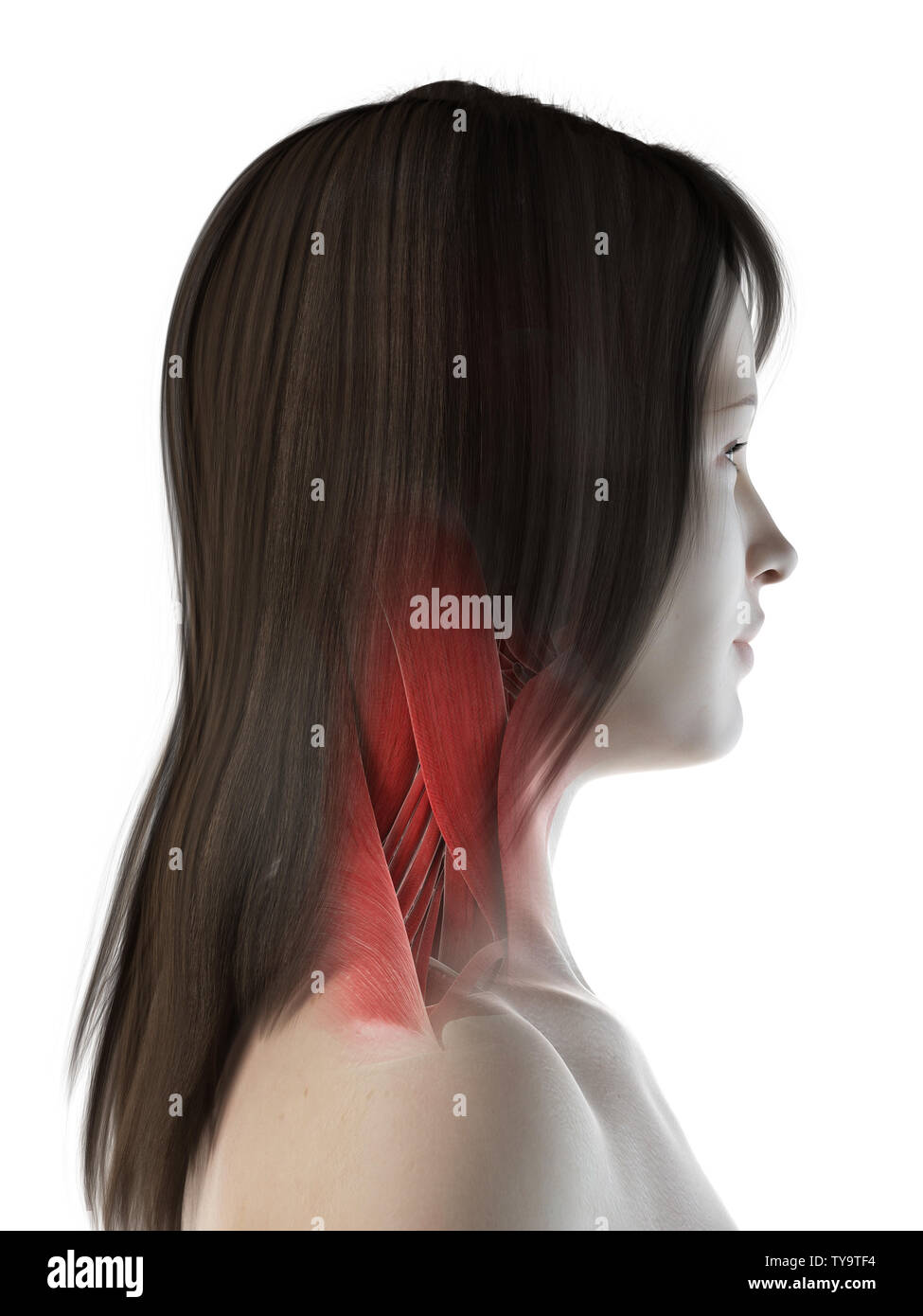 3d rendered medically accurate illustration of a females neck muscles ...