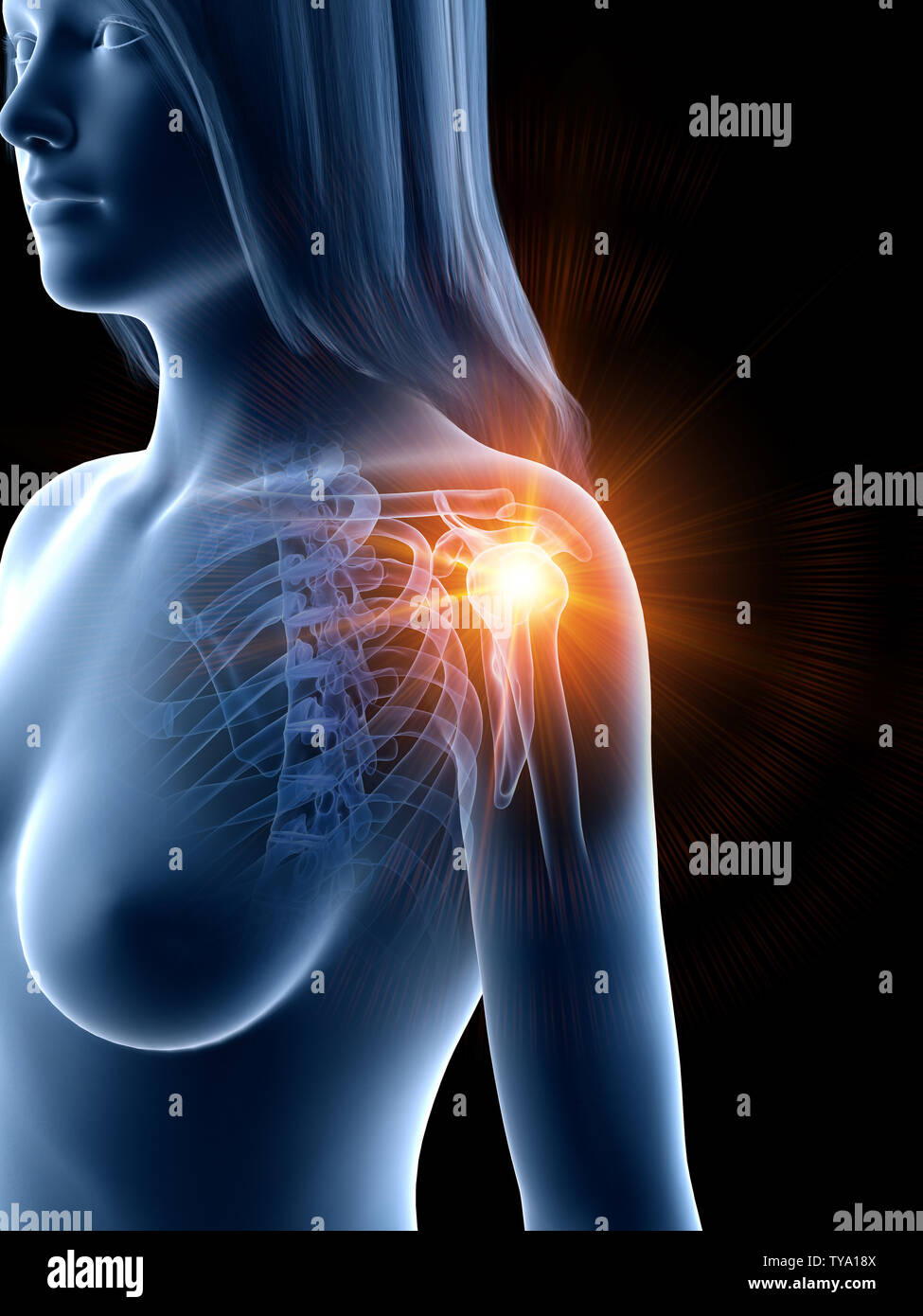 3d rendered medically accurate illustration of a painful shoulder Stock ...