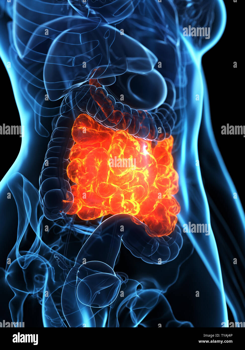 Intestine injury hi-res stock photography and images - Alamy