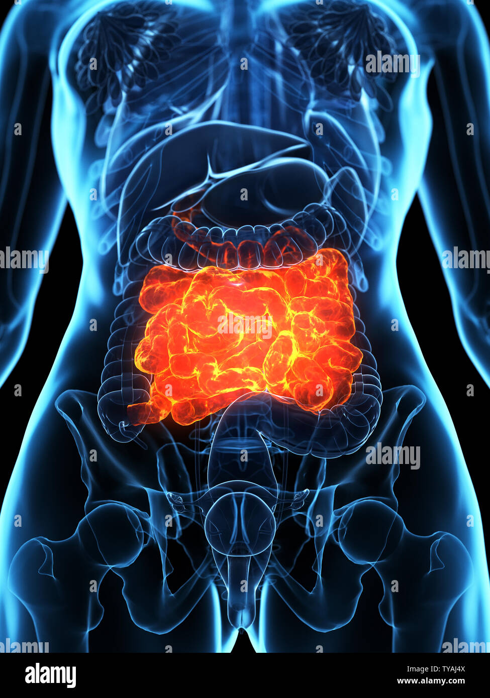 Diseases Of The Intestine at Dorothy Logan blog