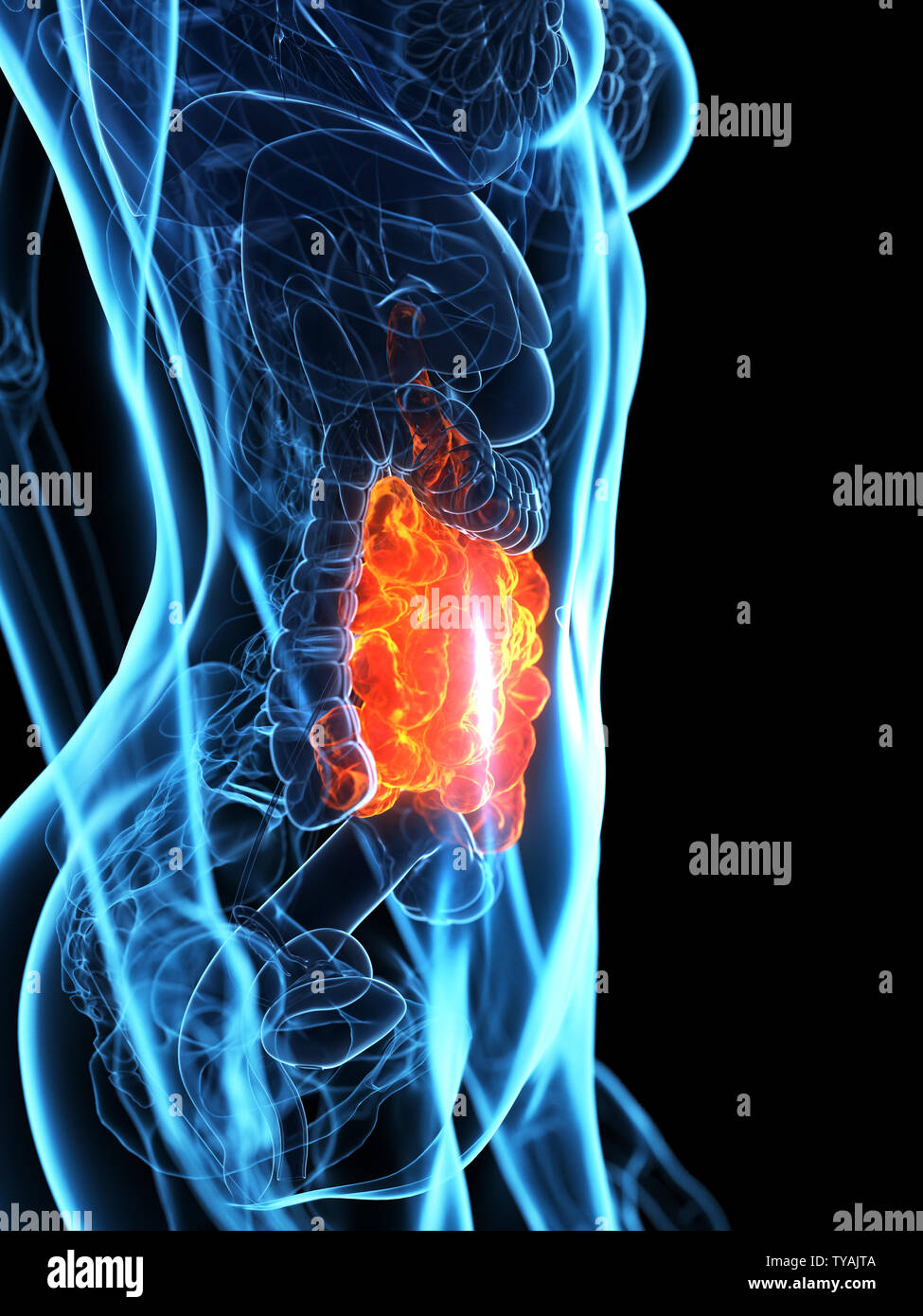 Diseases Of The Intestine at Dorothy Logan blog