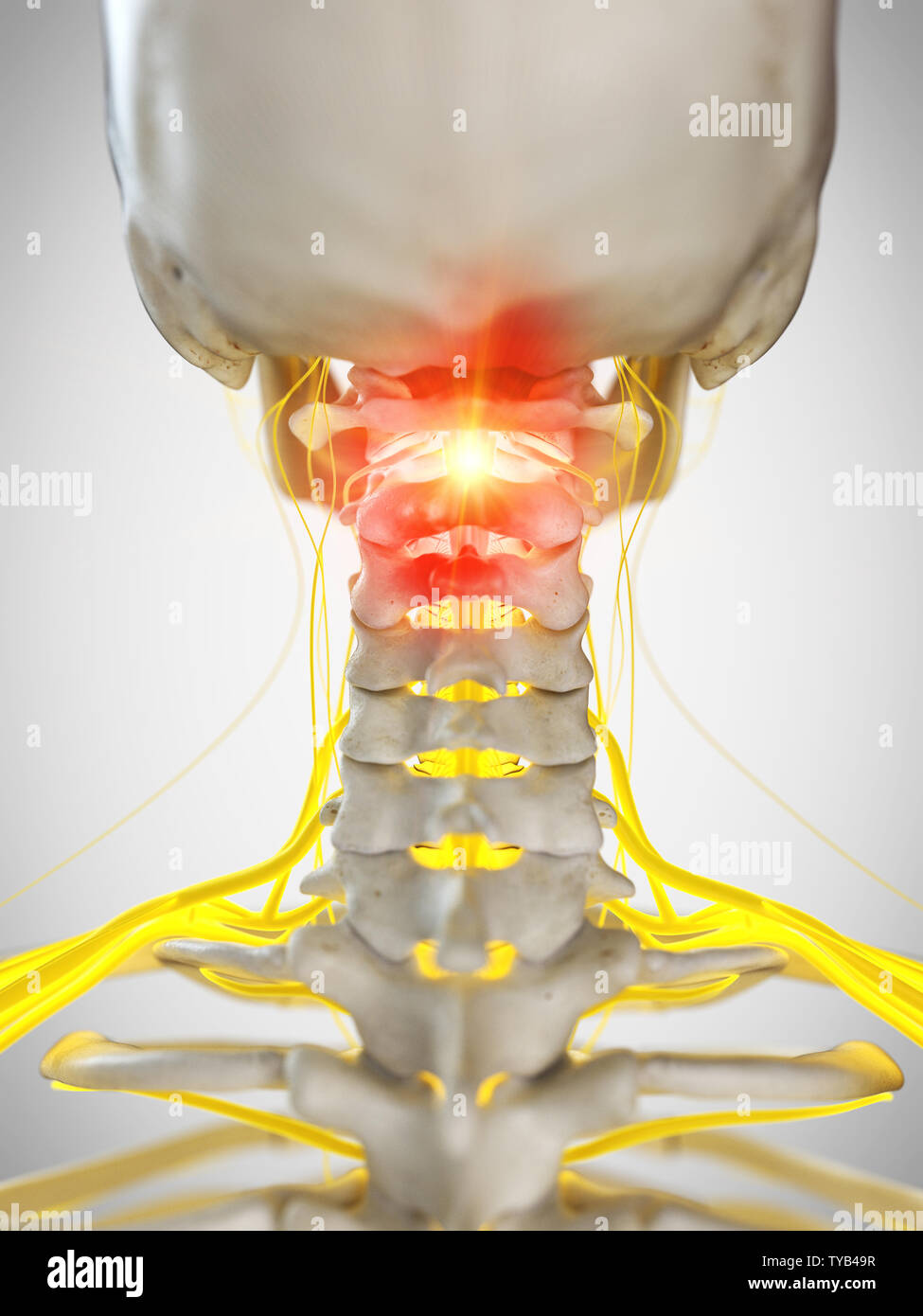 3d rendered medically accurate illustration of the necks of the nerve ...