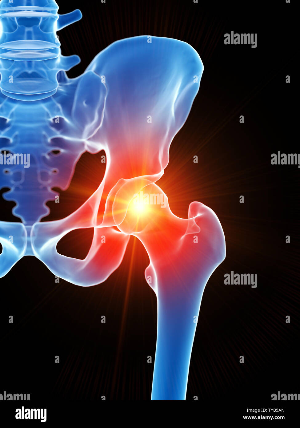 3d rendered medically accurate illustration of the hip joint showing ...