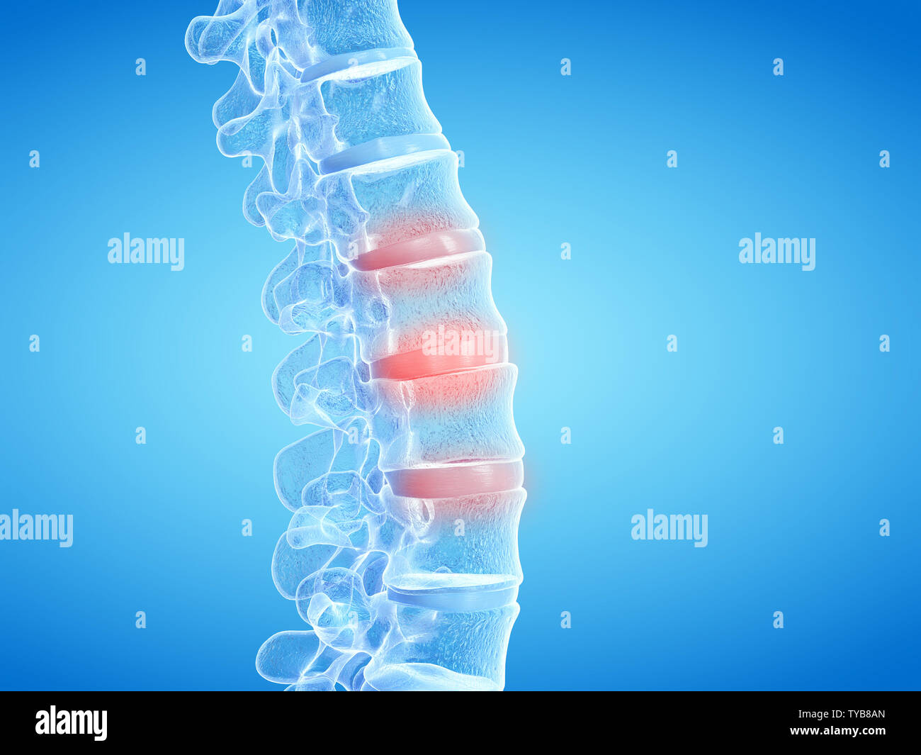 Intervertebral joints hi-res stock photography and images - Alamy