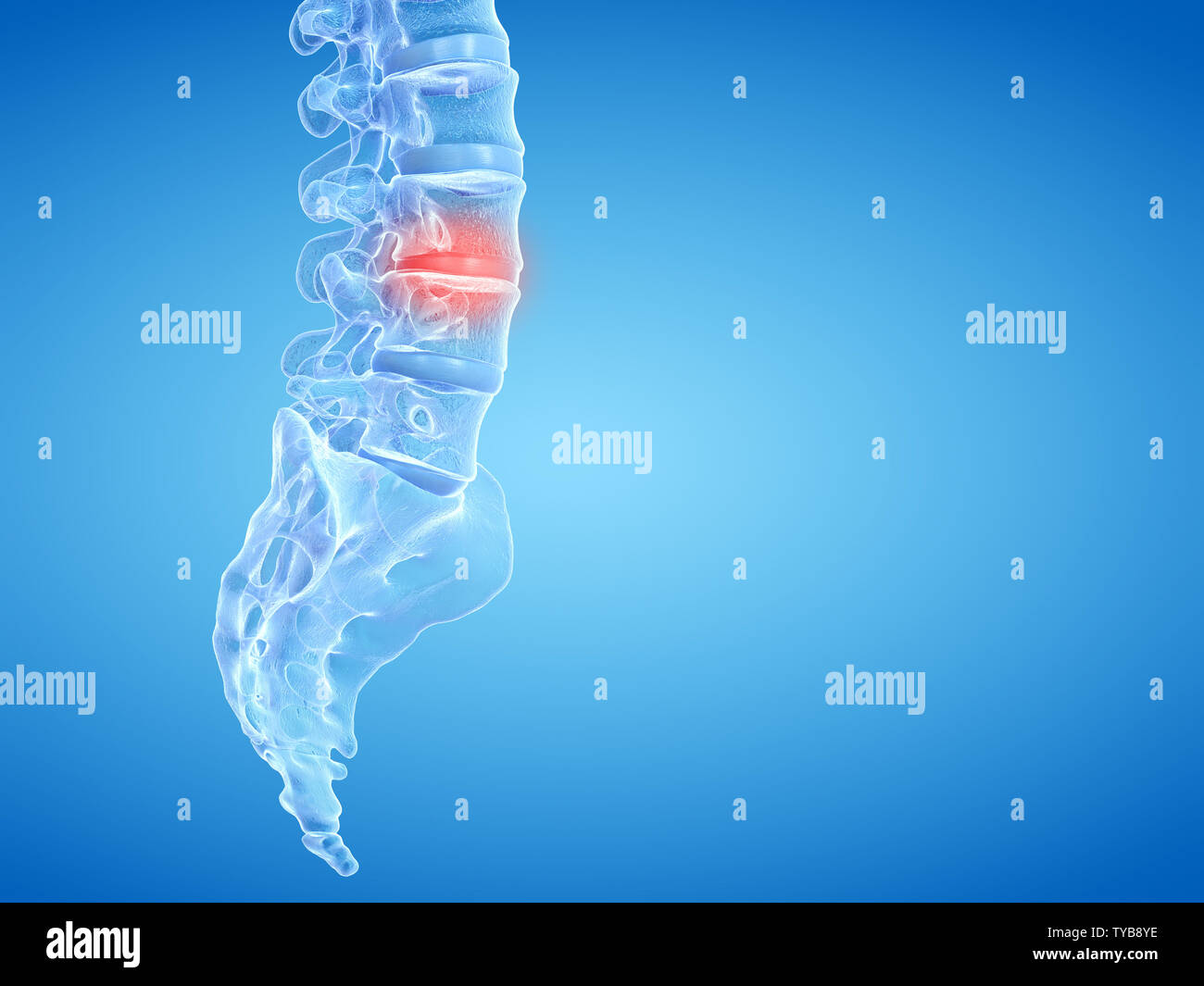 Intervertebral joints hi-res stock photography and images - Alamy