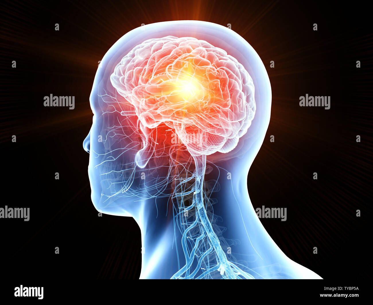3d rendered medically accurate illustration of human brain cancer Stock ...